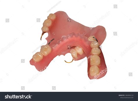 Upper Partial Denture