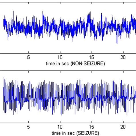 time frequency tf representations of eeg for seizure top and