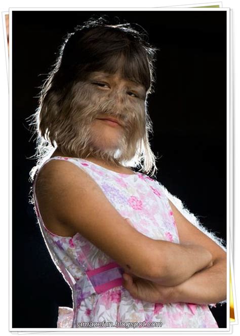 Amazing Fun Hairy Face Of Girl