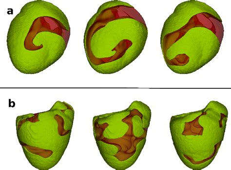 figure 3 from the effects of inhomogeneities on scroll wave dynamics in an anatomically