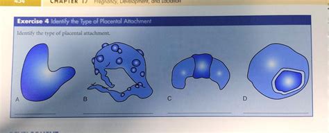 Solved Exercise 4 Identify The Type Of Placental Attachment Identify The Type Of Placental
