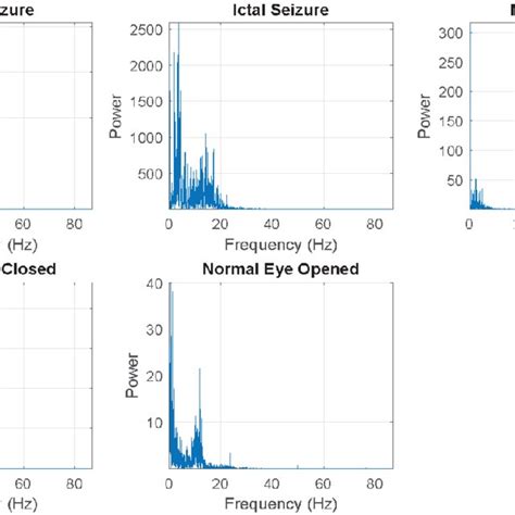 An Example Of Eeg Signal Different Power Spectrums Download