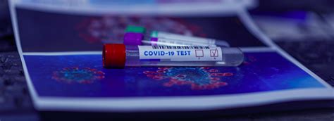 Covid 19 En Corse Encore 2 Décès Et 683 Nouveaux Cas En Une Semaine