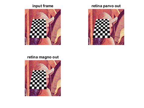 Retina Demonstration