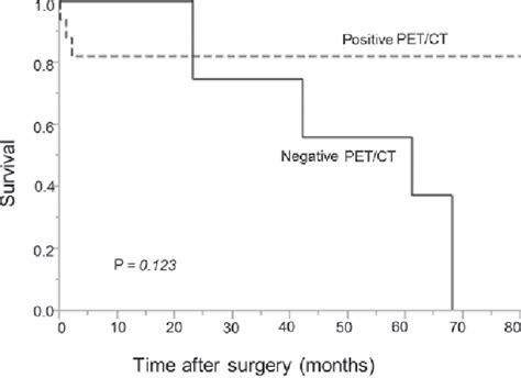 Figure 1 From Predicted Extracapsular Invasion Of Hilar Lymph Node Metastasis By Fusion Positron