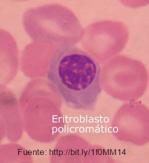 Nombre Eritroblasto policromático Rubricito Normoblasto policromático policromatófilo Tamaño