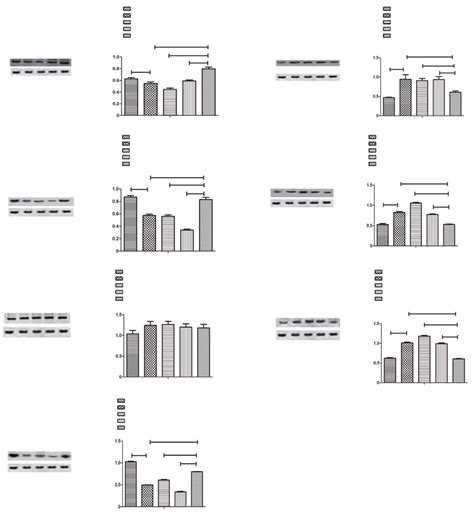 Bdnf Activates Pp2a And Inhibits Tau Phosphorylation Via The Pi3k