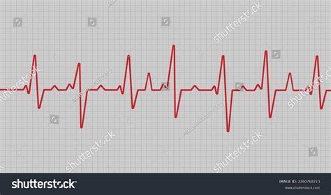 Red Heart Attack Ekg Electrocardiography Vector Stock Vector Royalty