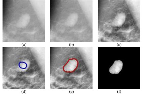 Block Diagram Of The Proposed Model A Original Image Mdb015 B Download Scientific Diagram