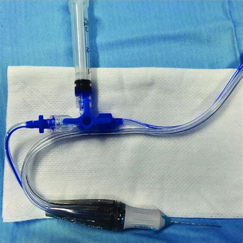 Connection Of The Syringe Containing The Vital Dye To The Vitrectomy Probe Download