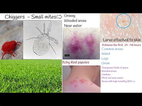 8 Things Tiny Green Bugs That Bite Identification Bites And Control Guide