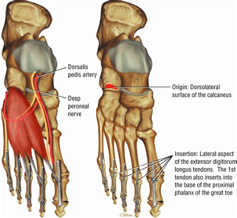 Extensor Digitorum Brevis Avulsion