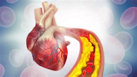 High Amount Of Good Cholesterol Levels Doesnt Guarantee Low Heart