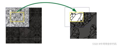 深度学习基础——u Net图像分割 Csdn博客