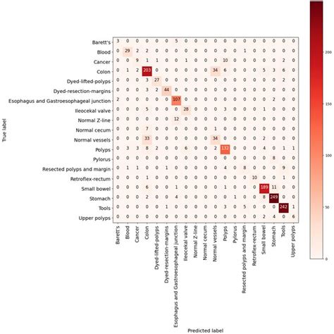 Confusion Matrix For The Best Outcome Obtained Using Pre Trained Resnet 50 Download