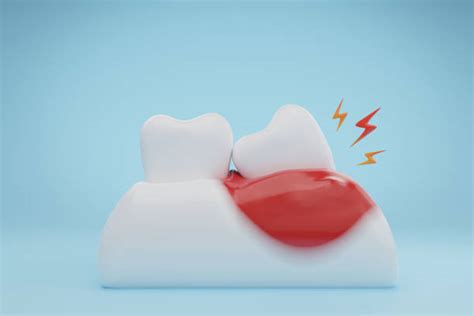 5800 Tandvlees Illustraties Stockfotos Afbeeldingen En Royalty Free