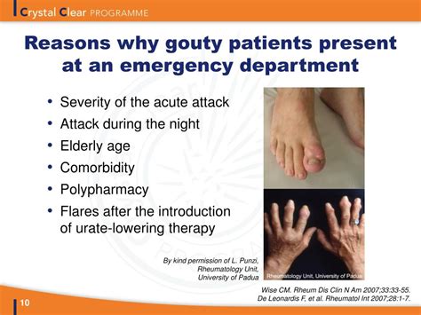 Ppt Difficult Gout Gout In The Elderly And Drug Induced Gout Powerpoint Presentation Id3733219