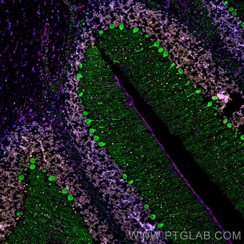 Flexable Hrp Antibody Labeling Kit For Mouse Igg1 Kfa025 Proteintech