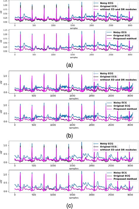 Figure 1 From Deep Neural Network Denoising Model Based On Sparse Representation Algorithm For