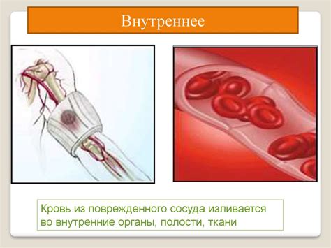 Первая помощь при кровотечениях презентация онлайн
