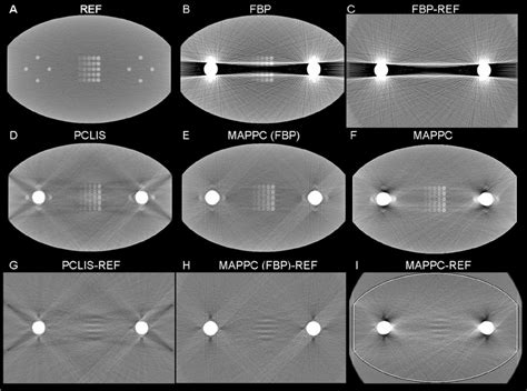 The Reconstructions Of The Simulated Hip Phantom The Window Used Was Download Scientific