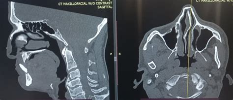 Do Annotation On Radiology Images By Davidjohnson121 Fiverr