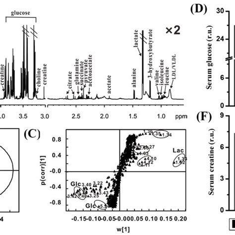 Nmr Based Serum Metabolomic Analysis A A Typical 1 H Nmr Spectrum Download Scientific