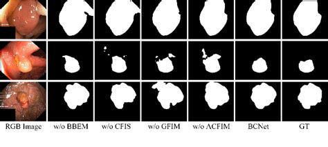 Figure 1 From Boundary Constraint Network With Cross Layer Feature Integration For Polyp