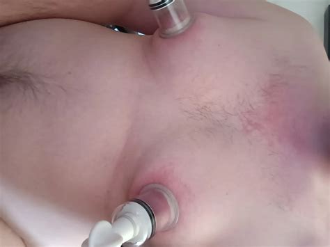 Nipple Suction Nude Pics Xhamster