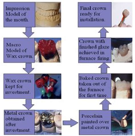 Figure 2 From Dental Crown Manufacturing Using Stereolithography Method Semantic Scholar