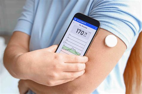 Real Time Cgm Shows Benefits Over Intermittently Scanned Cgm In T1d