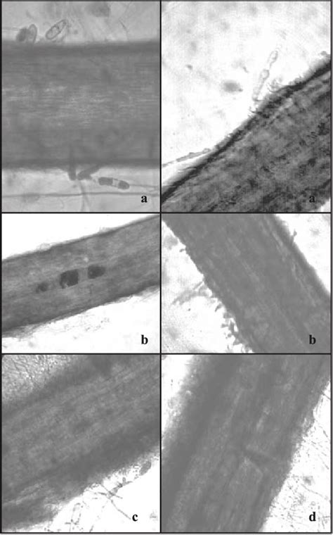 Perforation And Perforating Organs Produced By Epidermophyton Download Scientific Diagram