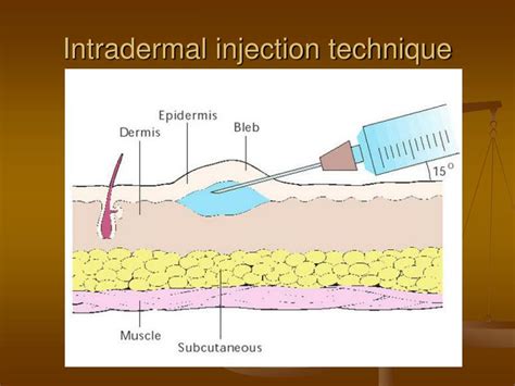 Ppt Injection Administration Techniques Powerpoint Presentation Free