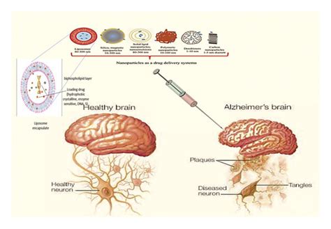 Diagrammatic Icv Injection For Different Forms Of Drug Loaded Nanosystems Download Scientific