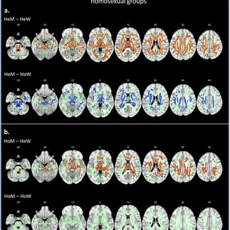 Whole Brain Voxel Wise Sex Differences In Fa P