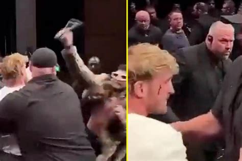 Footage Captures Exact Moment Logan Pauls Face Started Bleeding After