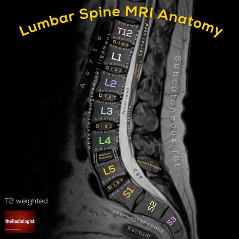 Sagittal T2 Weighted Image Of An Mri Of The Lumbar Spine ⁣ ⁣ Lumbar Spine Mri Anatomy⁣ 👨🏽‍💻this