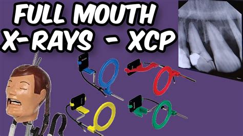 Full Mouth X Rays Xcp Tips And Tricks Youtube