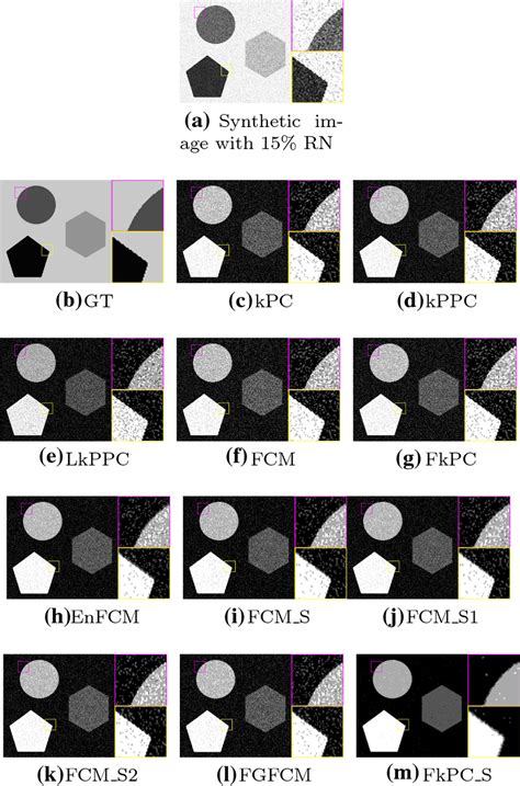 Qualitative Segmentation Performance Of Proposed Method And Related