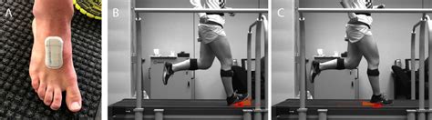 A Biostamprc Sensor Attached To The Dorsal Surface Of The Foot To Download Scientific Diagram