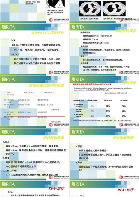 肺癌射频消融ppt课件 卡卡办公