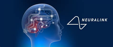 Pros And Cons Of Neuralink Brain Implant Insights From A Patient