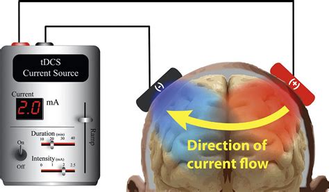 What Is Tdcs Understanding The Benefits Caputron