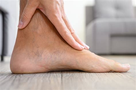 Why Are My Veins So Visible Causes And When To See A Doctor