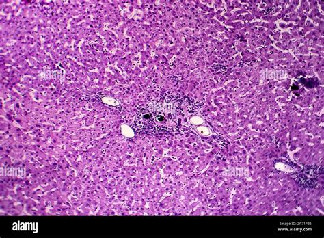 Liver Schistosomiasis Light Micrograph Photo Under Microscope Showing
