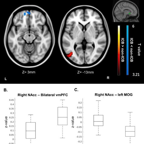 Seed Based Correlation Analysis Comparing The Functional Connectivity Download Scientific