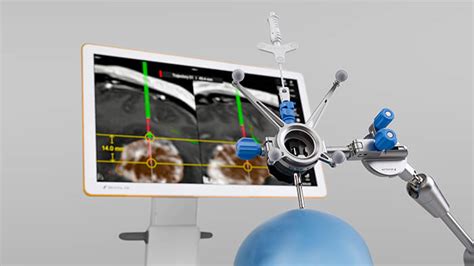 Cranial Navigation Advanced Neuronavigation Brainlab