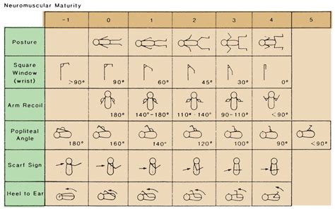 Maturational Assessment Of Gestational Age New Ballard Score Member Login Oakes Academy