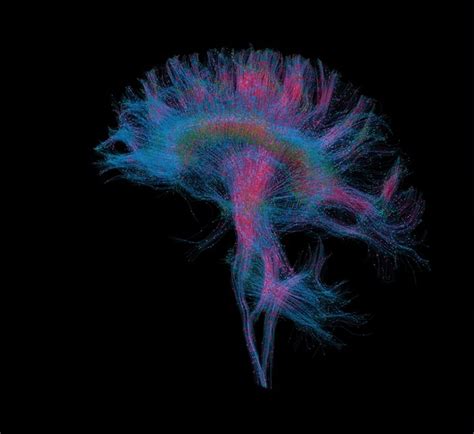 Diffusion Tensor Imaging Royalty Free Images Stock Photos Pictures Shutterstock