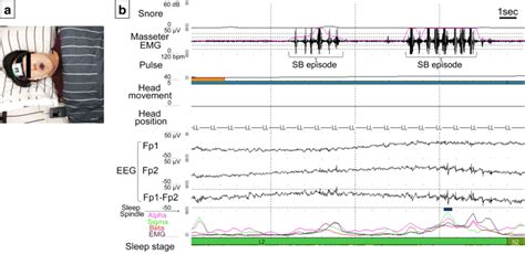 Portable Device And Analytical Software Polysomnography Recordings Download Scientific Diagram